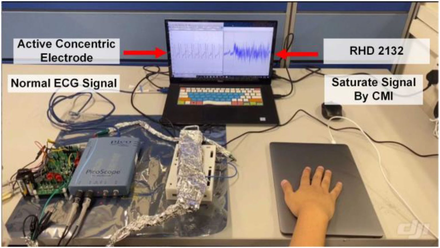 NUS SHINE – An Active Concentric Electrode for Concurrent EEG Recording ...